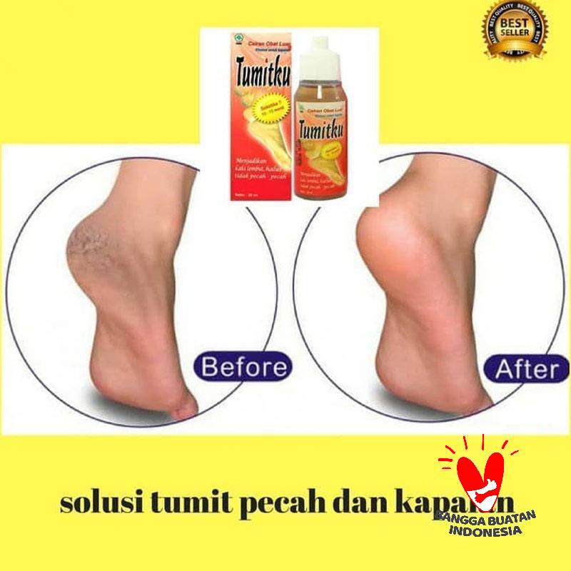 Promo Tumitku Instan Gels Diskon 35% di Seller luminary - Serpong, Kota ...