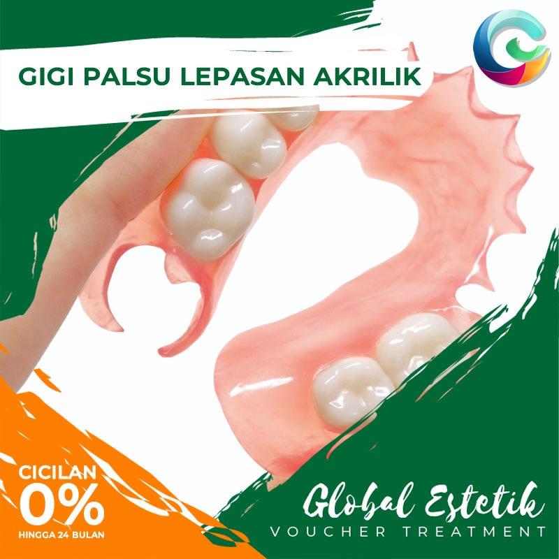 Promo Global Estetik Gigi Palsu Lepasan Akrilik Tiket Treatment Diskon 11% Di Seller Global ...