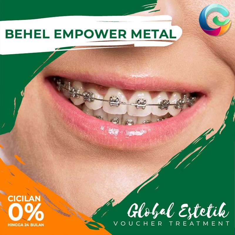 Jual Behel Metal Terbaik - Harga Terbaru 2026