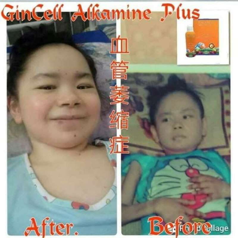 Jual Salaam Gincell Alka-min Plus Stem Sel Ginseng Liar Di Seller ...