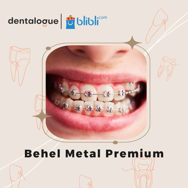 Promo Behel Metal Premium Diskon 38% Di Seller Dentalogue Dental Clinic ...