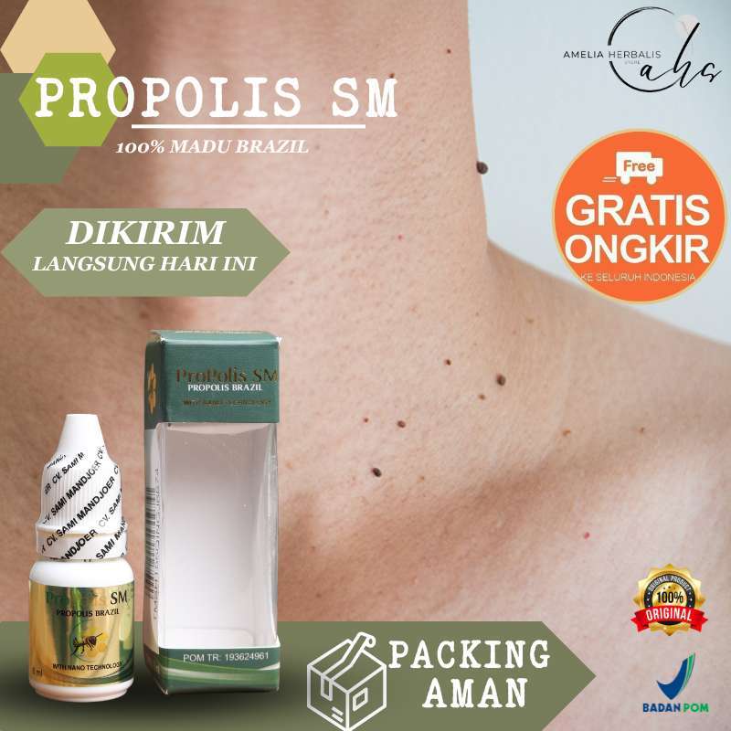 Jual Obat Papiloma Di Dada, Obat Papiloma Di Kelopak Mata, Obat ...