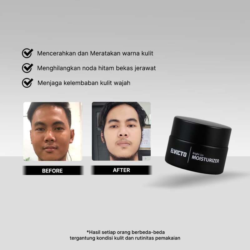 Jual Elvicto Bright Up Moisturizer Di Seller Elvicto.id - Jaticempaka ...