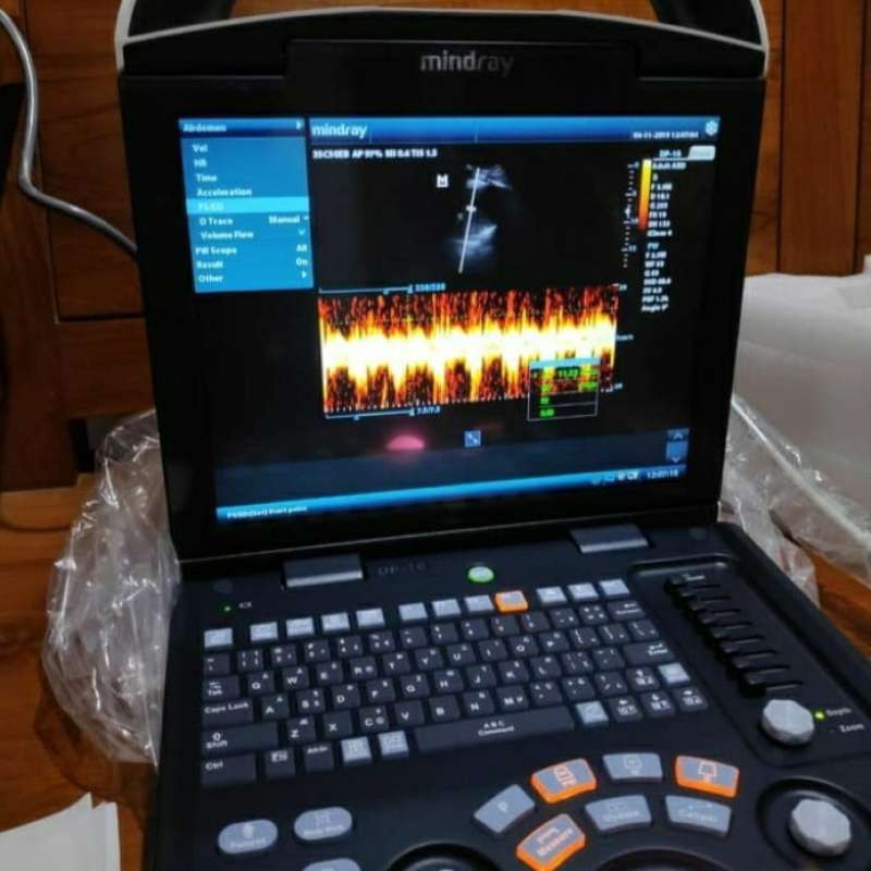 Jual USG dp 10 mindray + Doppler dan probe di Seller Laylaa Shop ...