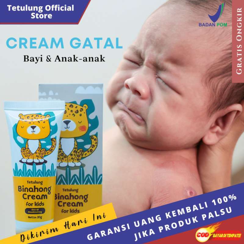 Jual Salep Binahong Cream Anak - Obat Gatal, Alergi Jamur Dan Ruam Bayi ...