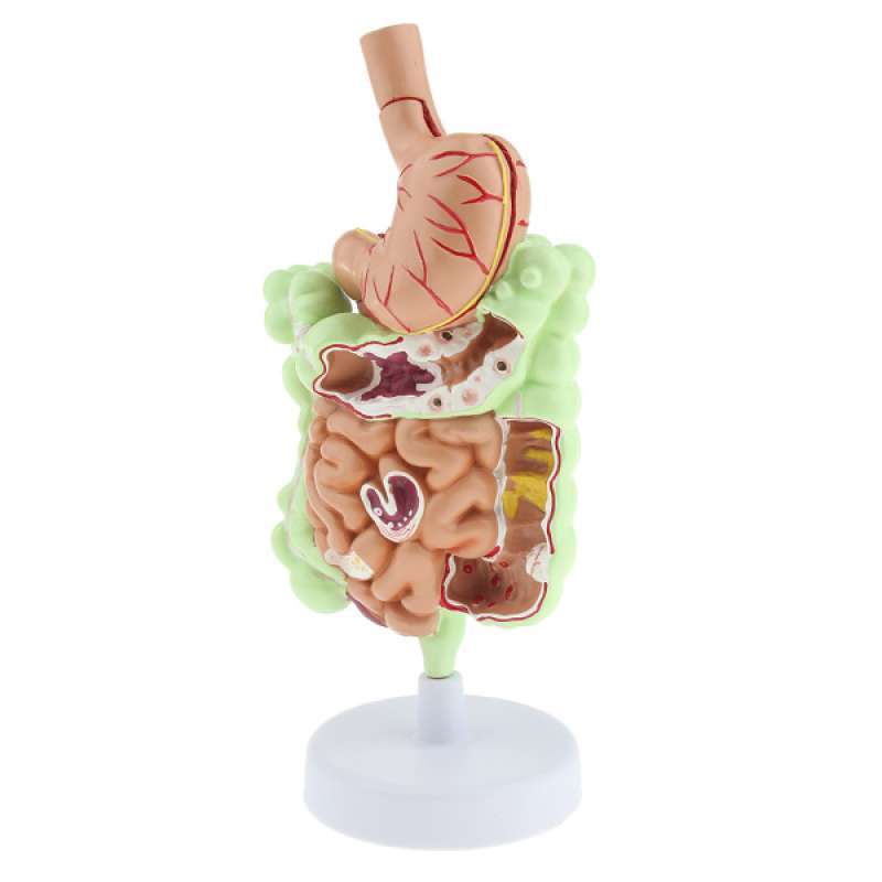 Jual Human Stomach Gastrointestinal Anatomy Model For Class Teaching ...