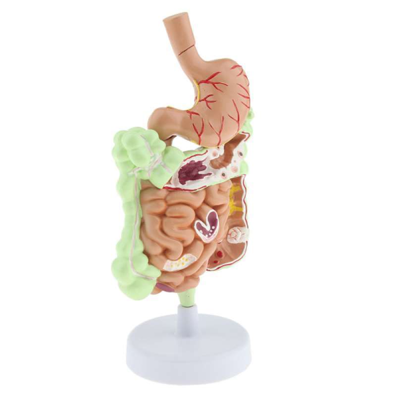 Jual Human Stomach Gastrointestinal Anatomy Model For Class Teaching ...