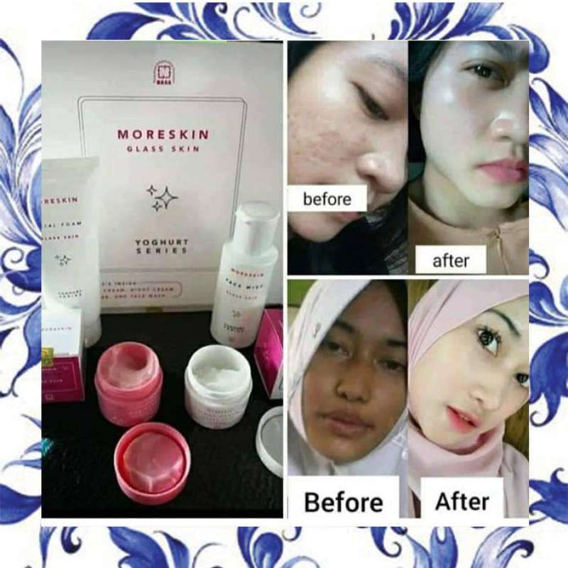 Jual Glaskin Glasskin Produk Nasa Perawatan Wajah Paket Moreskin ...