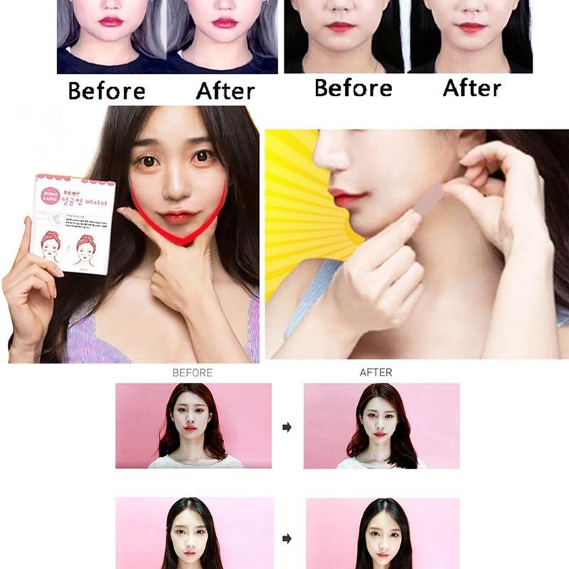 Jual Yangunik Dodo Label V Shape Face Plester Pipi Penirus Wajah [40 Pcs] Di Seller Toko Soraya ...