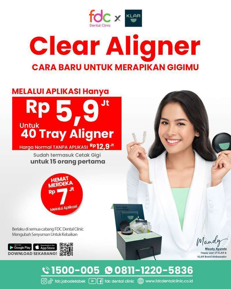 Jual Luxury Aligner Klar Di Seller Fdc Dental Clinic - Pondok Aren 1 - Jurang Mangu Barat, Kota ...
