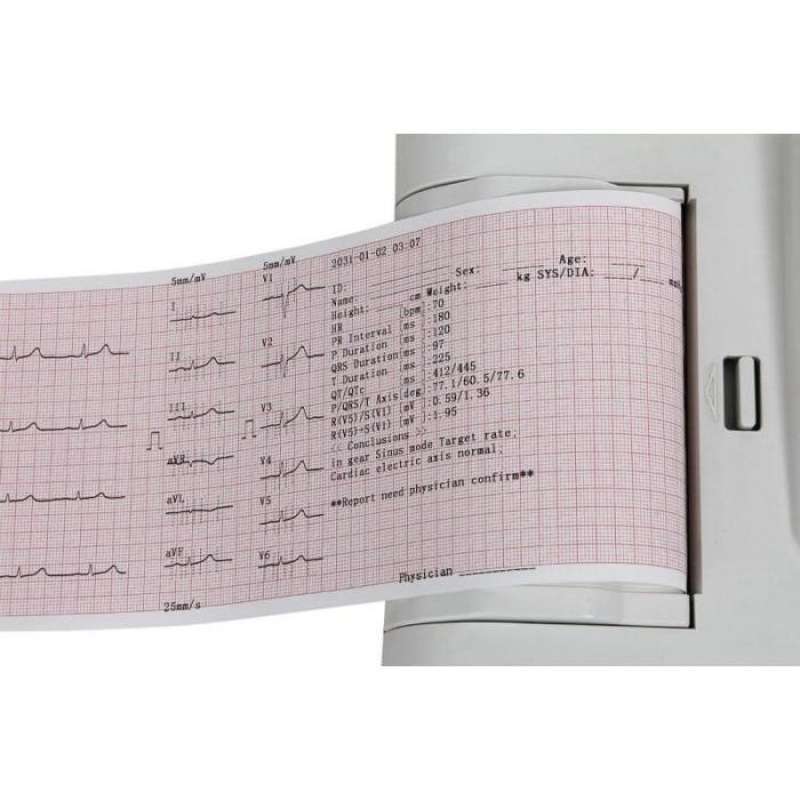 Jual Mesin Electrocardiograph 6 Channel Printer Analisys Ce Touch Ecg ...