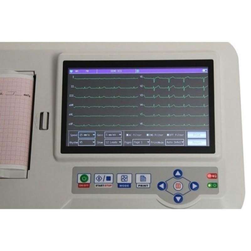 Jual Mesin Electrocardiograph 6 Channel Printer Analisys Ce Touch Ecg ...