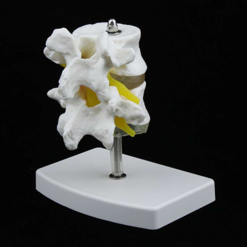 Promo 2-Section Life-Size Human Lumbar Vertebrae Model with Base ...