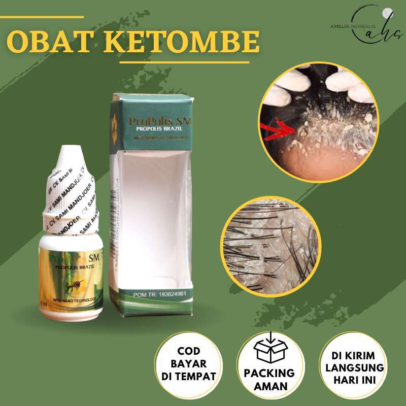 Obat Ketombe Kulit Kering Lengkap Harga Terbaru Juni 2024 | Blibli
