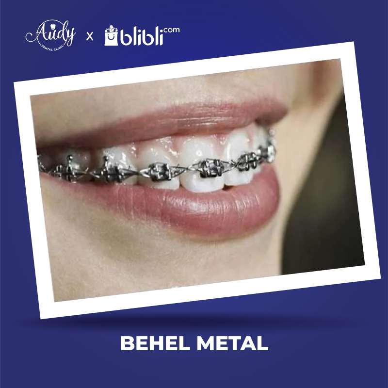 Jual Behel Metal American Mini Master Di Seller Audy Dental Pondok ...