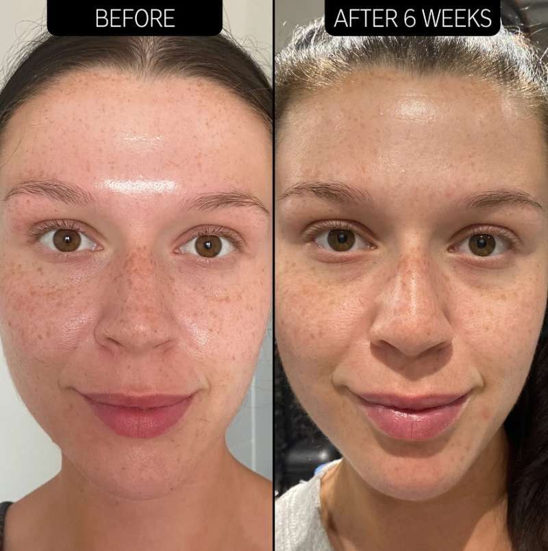 Jual The Inkey List Supersolutions Excess Oil Solution 20% Niacinamide ...