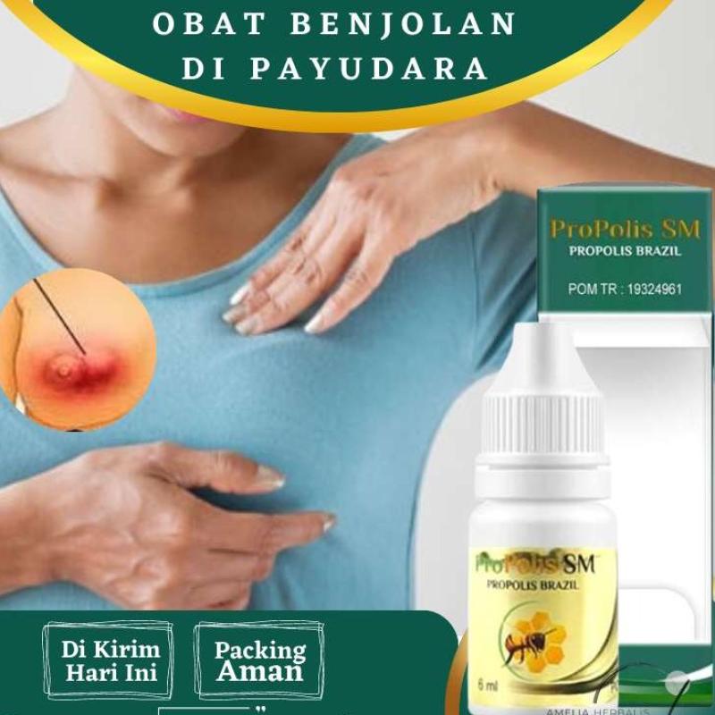 Jual Obat Tumor Benjolan Payudara 🏷️ 100% Original, Harga & Kualitas ...