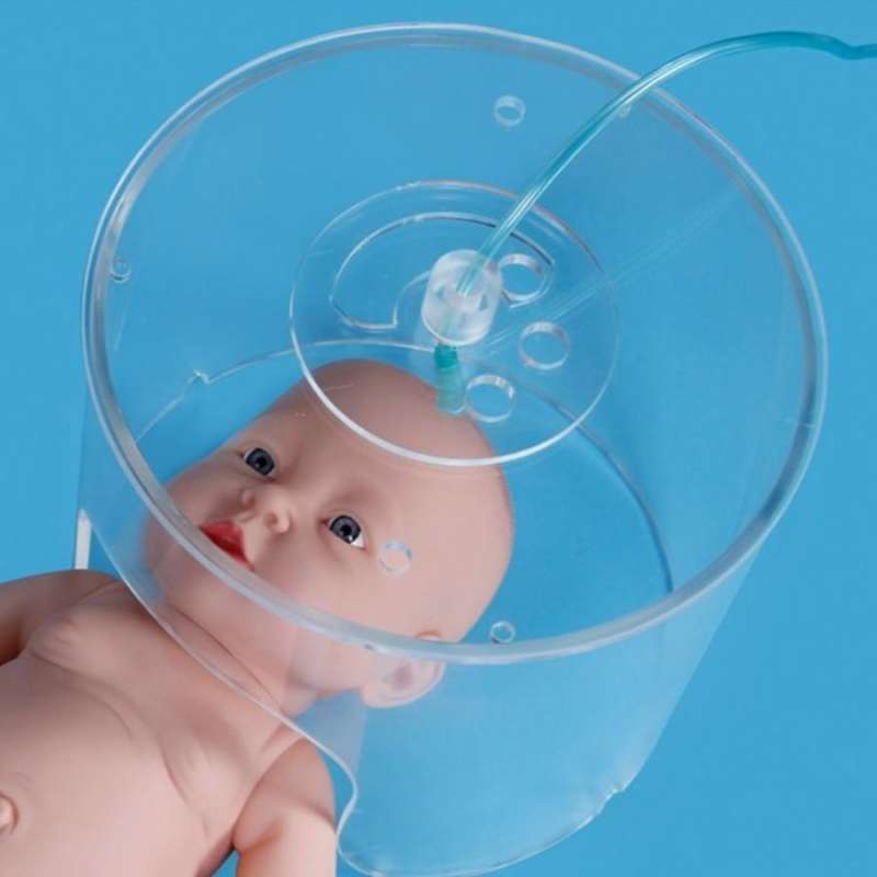 Jual Headbox Bayi, Head Box Bayi Premature, Terapi Oxygen Bayi Di ...