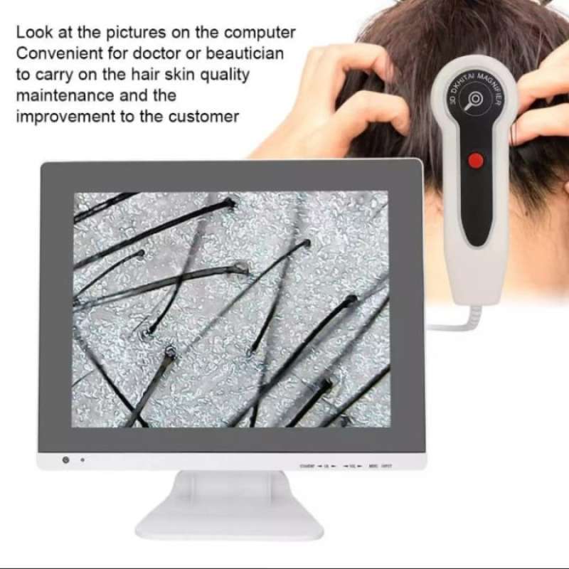 Jual USB Skin and Hair Analyzer LED PC / Laptop Alat Cek Kulit Rambut ...
