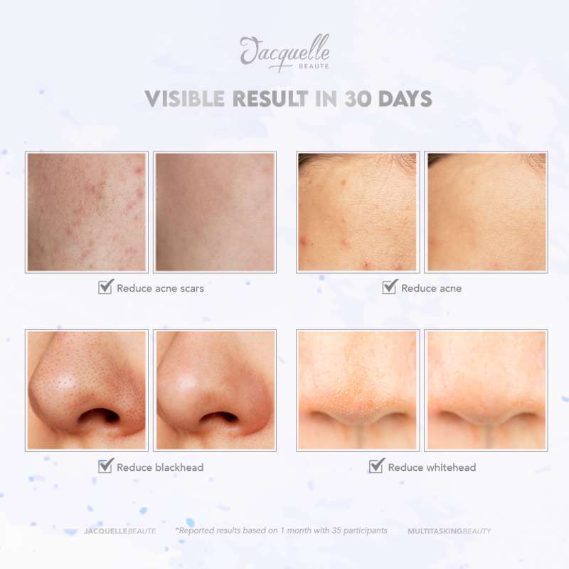 Jual [150rb Dapat 2] Deep Double Cleansing Kit - Aha Bha Goodbye Black ...