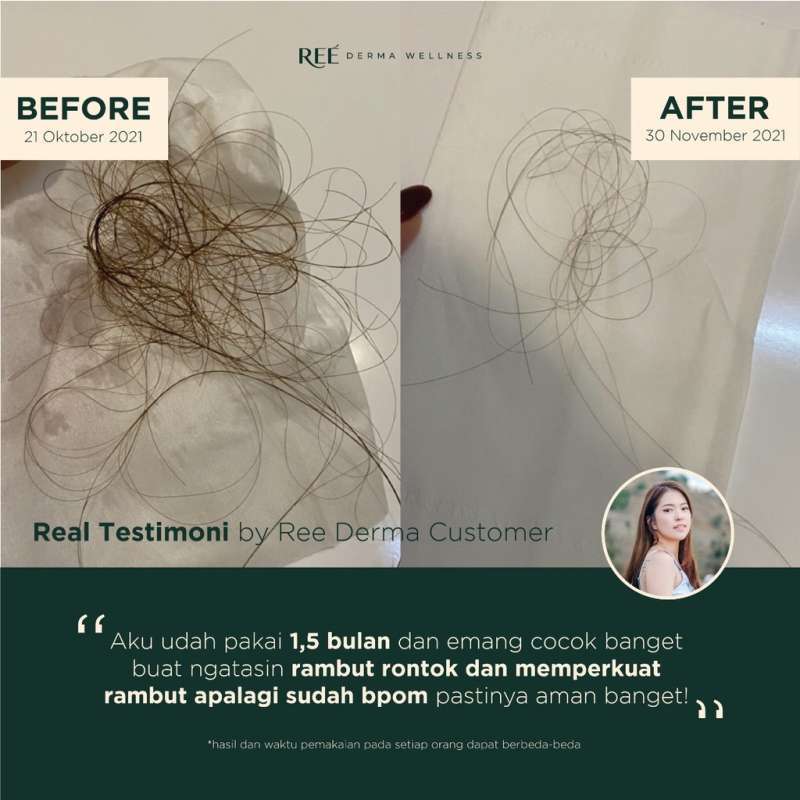 Jual Ree Derma Wellness Hot Oil Hair & Scalp Treatment Di Seller Ree ...