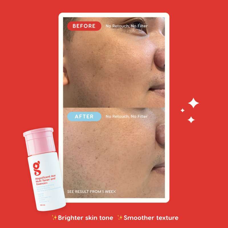 Jual Koerx | Gorjes Magnificent Ace Multi Toner And Essence 100 Ml Di ...