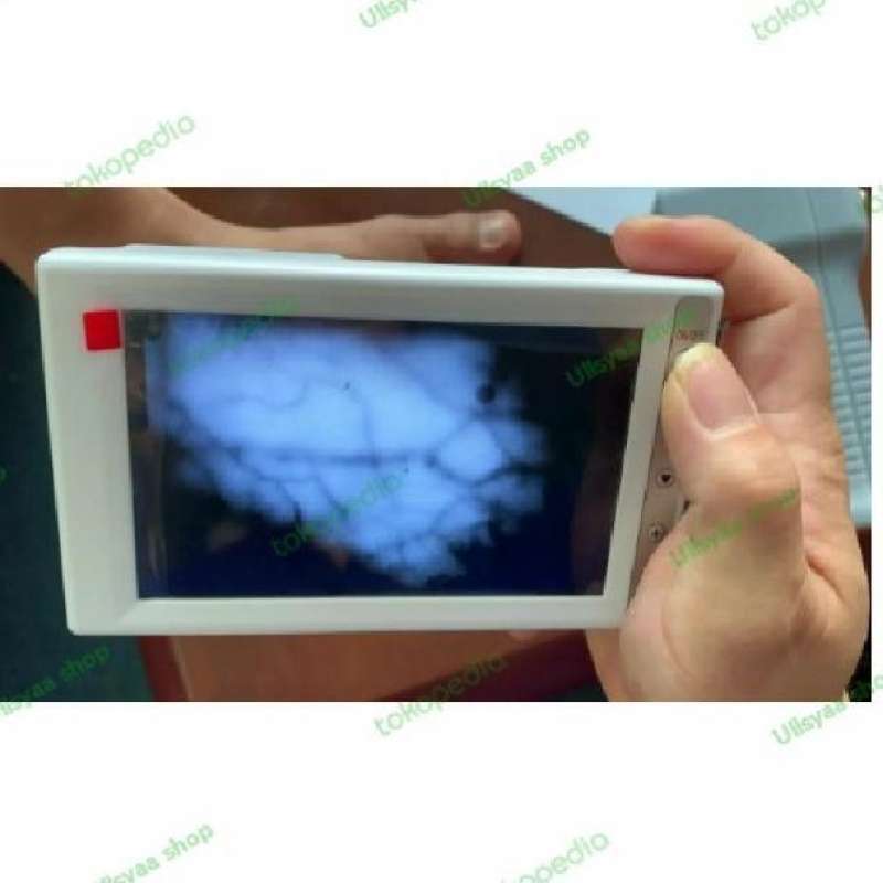 Jual Medical Vein Imaging Device Veinpuncture Using Vein Viewer Vein ...