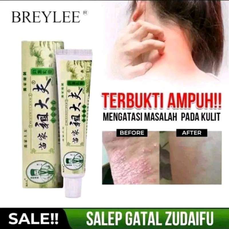 Promo Zudaifu Traditional Multi-plant Herbal Ointment Antibacterial ...