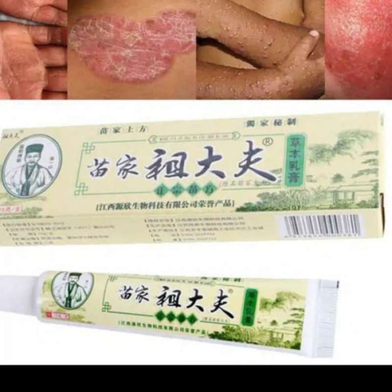 Jual Saleb Herbal Kulit Untuk Psoriassis,dermatitis, Eksim Di Seller ...