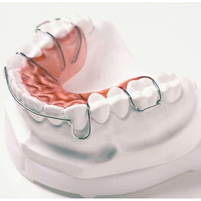 Jual Hawley Retainer di Seller Crown Dental Solution - Semolowaru, Kota ...