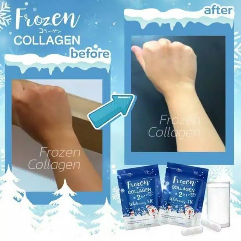 Jual FROZEN COLLAGEN 2 in 1 Whitening X10 [60 Capsul] di Seller ...