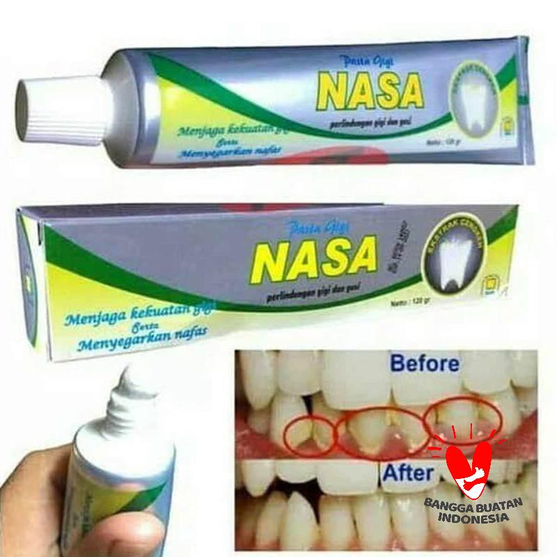 Jual Nasa Pasta Gigi [original] Di Seller Rohman Grosir Herbal Nasa ...