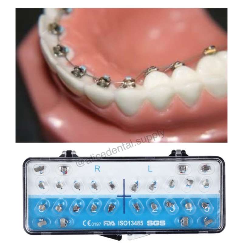Jual Lingual Bracket Braces Set Free Molar Tube Di Seller Nur Nur Toko ...