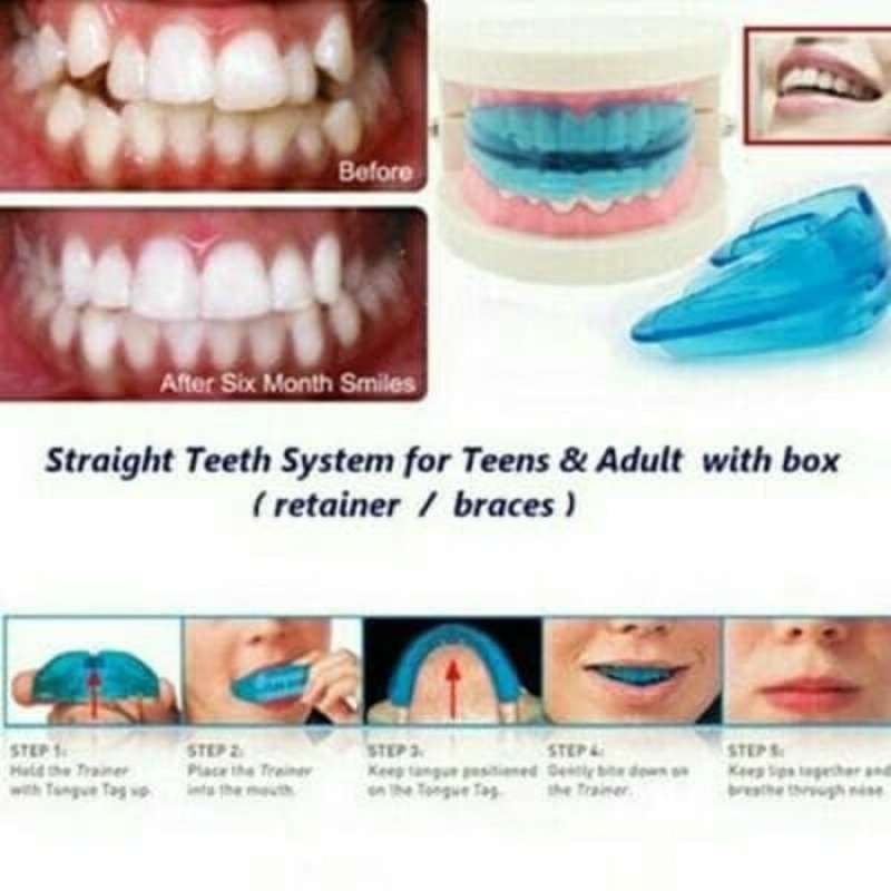 Jual ORTHODONTIC RETAINER GIGI RAPI TRAINER ALIGNMENT ORTHODENTIC BEHEL ...