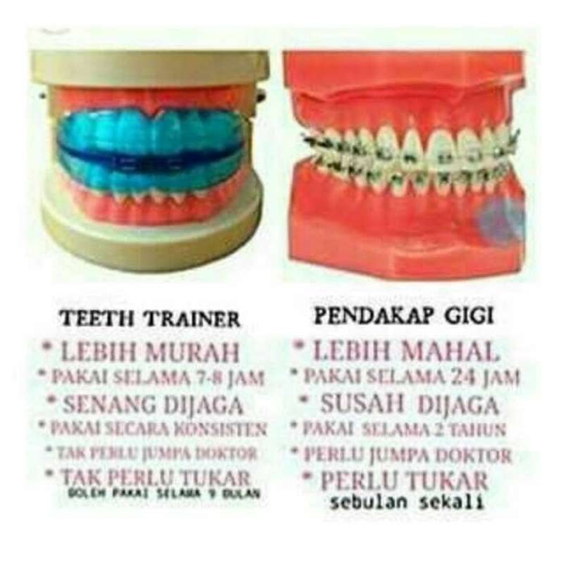 Jual ORTHODONTIC RETAINER GIGI RAPI TRAINER ALIGNMENT ORTHODENTIC BEHEL ...
