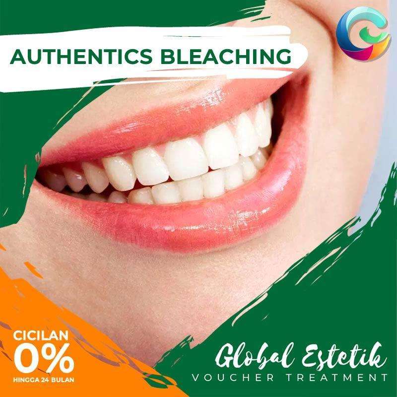 Promo Global Estetik Authentic Bleaching Ticket Treatment Diskon 31% Di ...