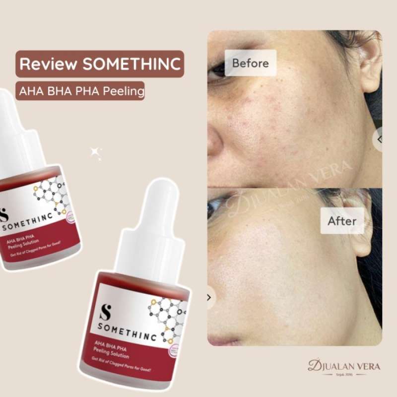 Jual Somethinc Aha Bha Pha Peeling Solution 20Ml di Seller Kagura Store - Kota Jakarta Selatan ...