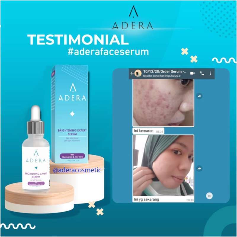 Jual Adera Brightening Expert Serum - Beli 2 Di Seller Adera Cosmetic - Kemayoran, Kota Jakarta ...