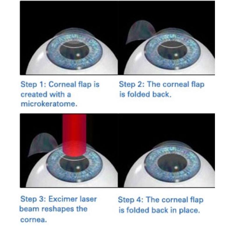 Promo Jec Eye Hospital 7 Dimension Z-lasik Voucher Kesehatan Senilai Rp ...