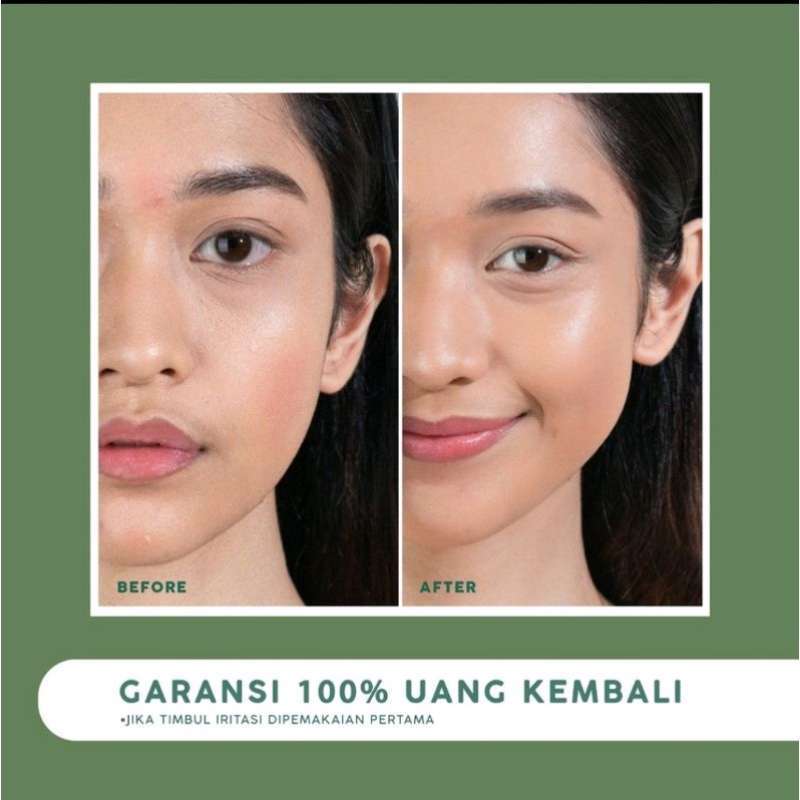 Jual Elformula Intensive Pore Clay Mask 100ml Di Seller Shishi.care ...