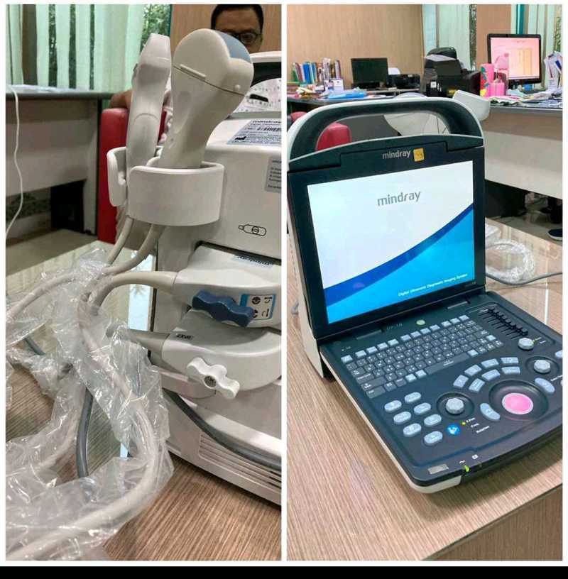 Mindray Usg Dp 30 Lengkap Harga Terbaru Februari 2024 | Blibli