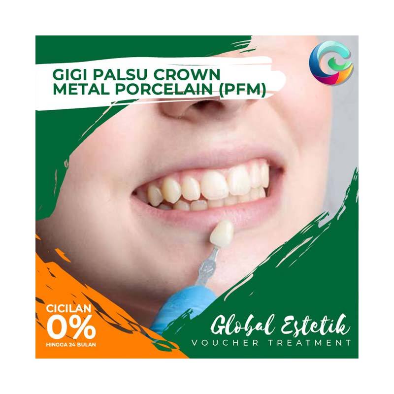Promo Global Estetik Gigi Palsu Permanen Metal Porcelain (PFM) Tiket Treatment Diskon 25% di ...