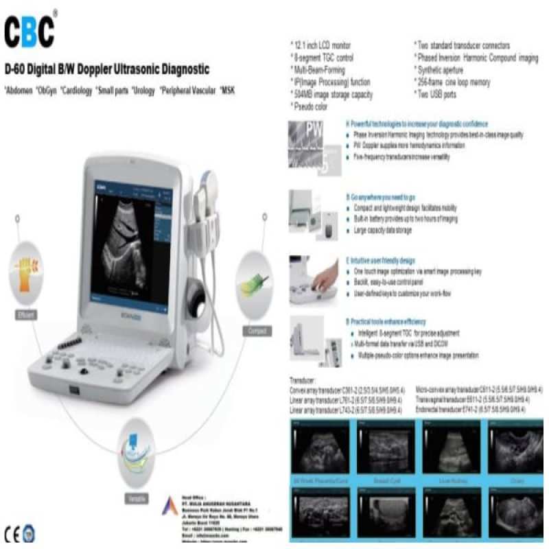 Jual Cbc Usg D60 Ultrasonography Digital Power Doppler Di Seller Mancbc ...