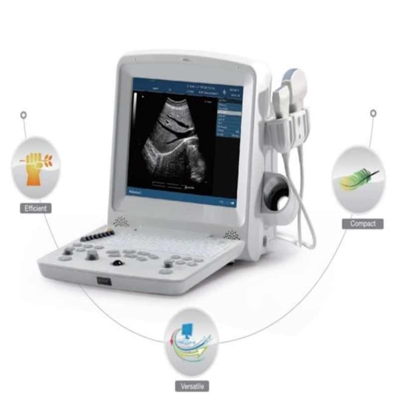 Jual Cbc Usg D60 Ultrasonography Digital Power Doppler Di Seller Mancbc ...
