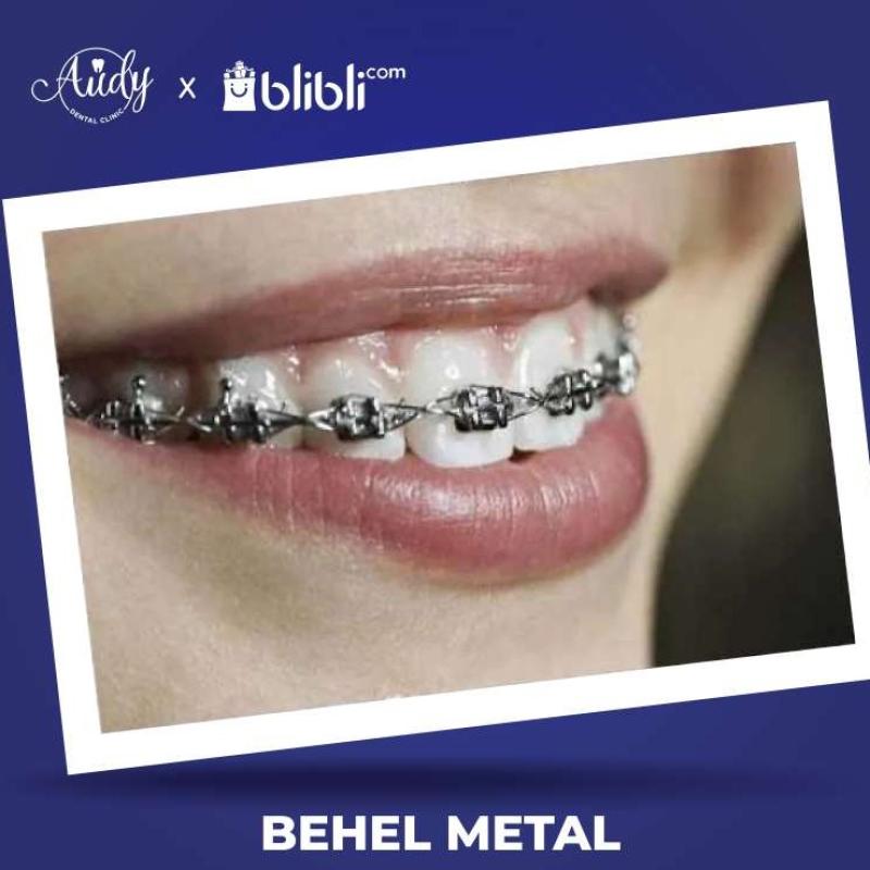 Jual Behel Metal American Mini Master di Seller Audy Dental Bandung ...