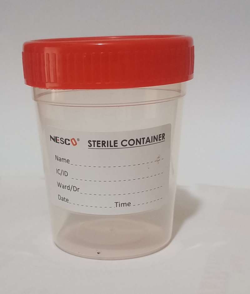 Jual Nesco Pot Urine Sterile Container Sampel Urin 100 Ml Di Seller Pt ...