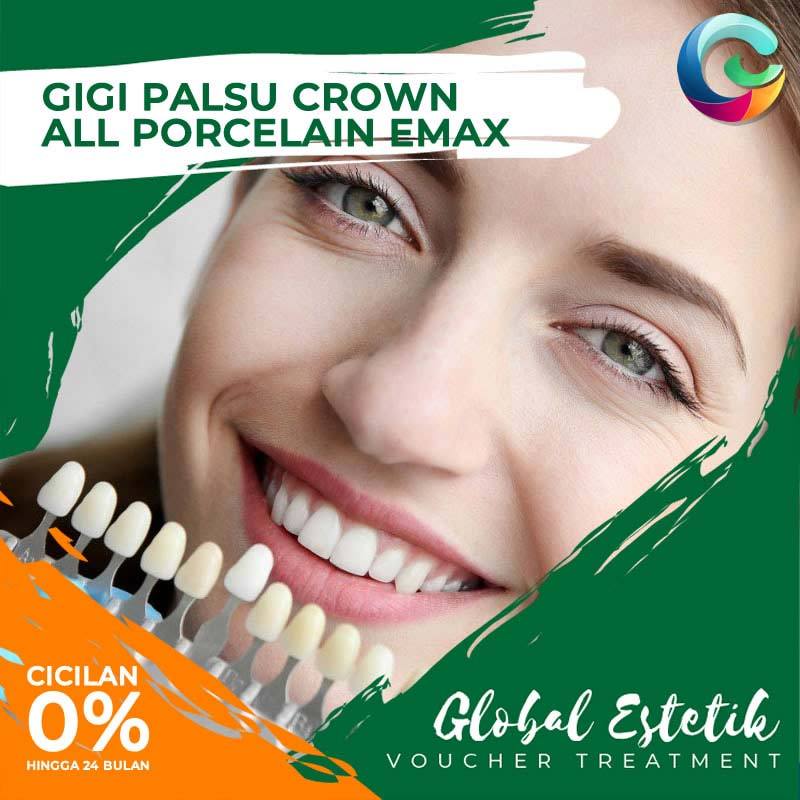 Promo Global Estetik Gigi Palsu Permanen All Porcelain Emax Tiket Treatment Diskon 10% Di Seller ...