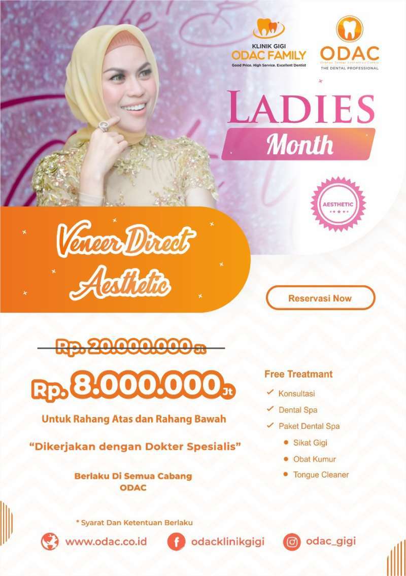 Jual Voucher Perawatan Direct Veneer di Seller odac family - Kota ...