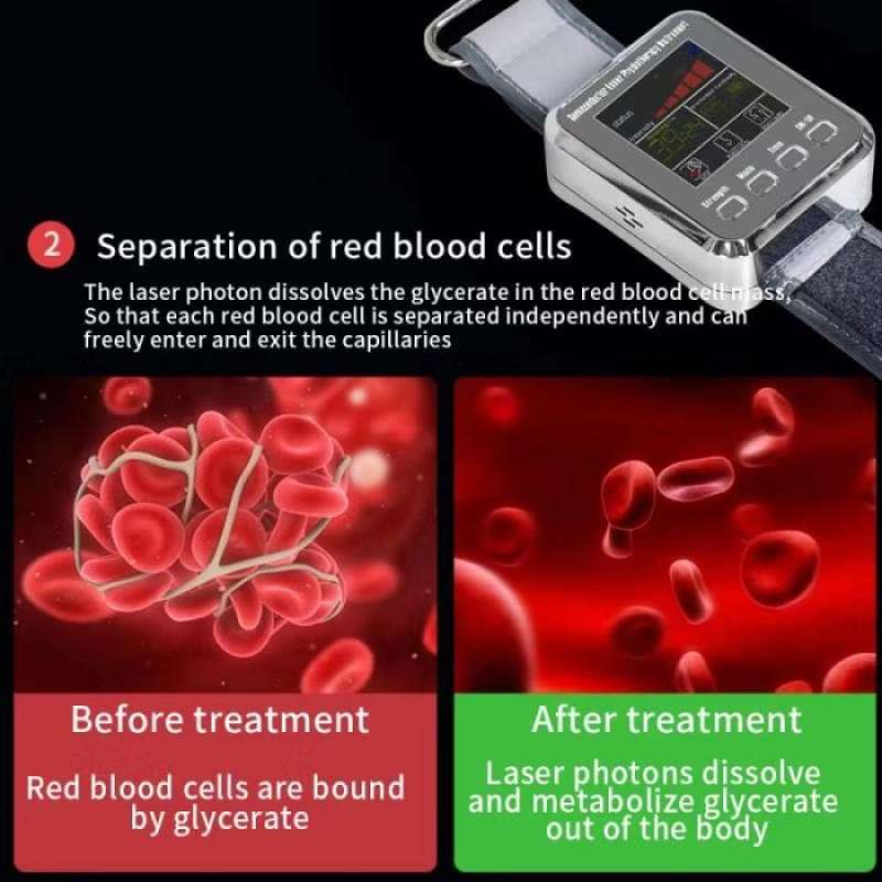 Jual Jam Tangan Terapi Laser Kesehatan 12 Titik Untuk Diabetes ...