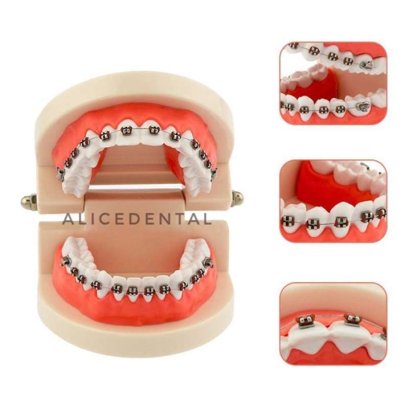 Jual Alice Dental Model Studi Ortho Study Phantom Gigi Typodont ...